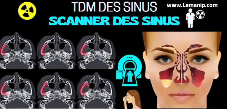 TDM DES SINUS