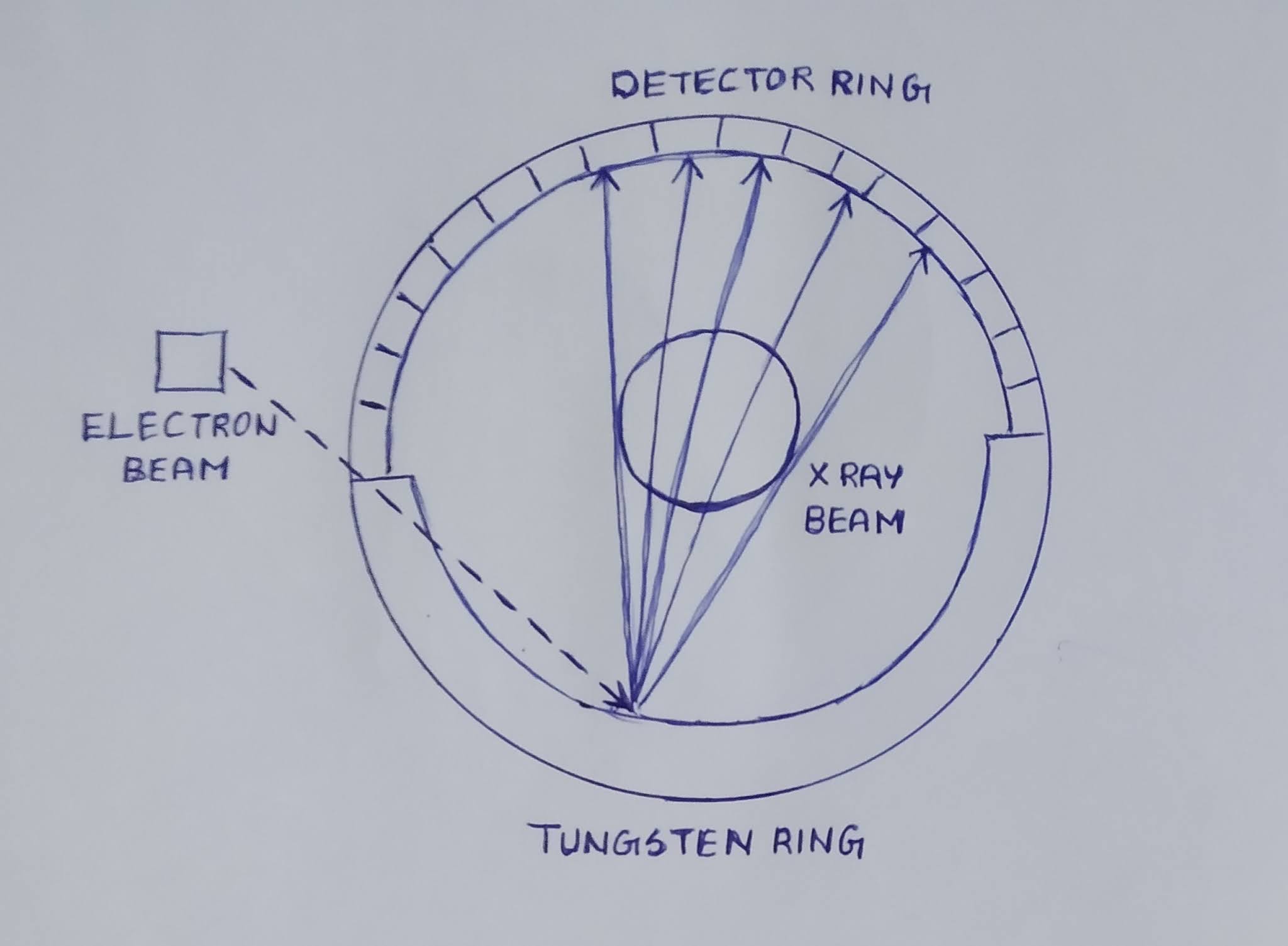 Biomedical Views: Generations of CT Scanners