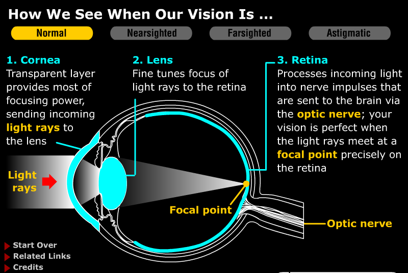 Human Eye - how it works, Eye Disease, Eye Problems