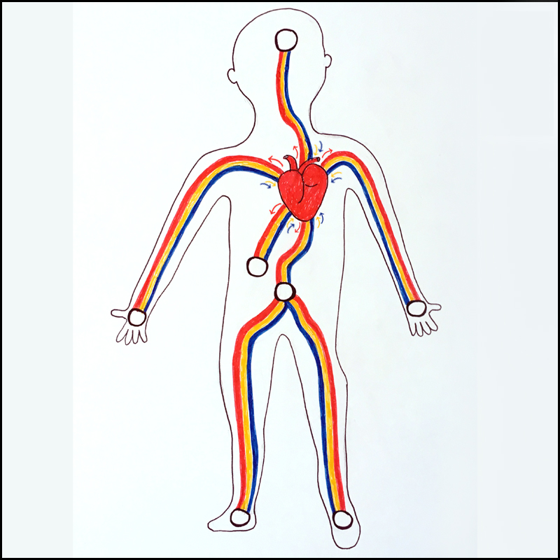 Ingrijire limfedem & lipedem : Limfedemul pe înţelesul tuturor