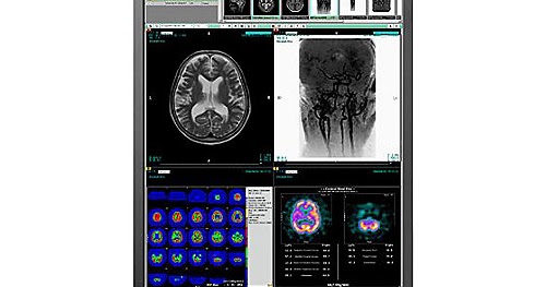 Hiliex Advanced Medical Technologies: Eizo RadiForce RX350 (RX350-BK ...