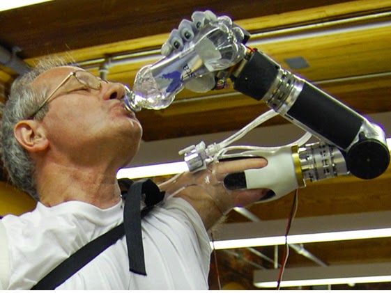 Luke Arm - How long between invention and innovation?