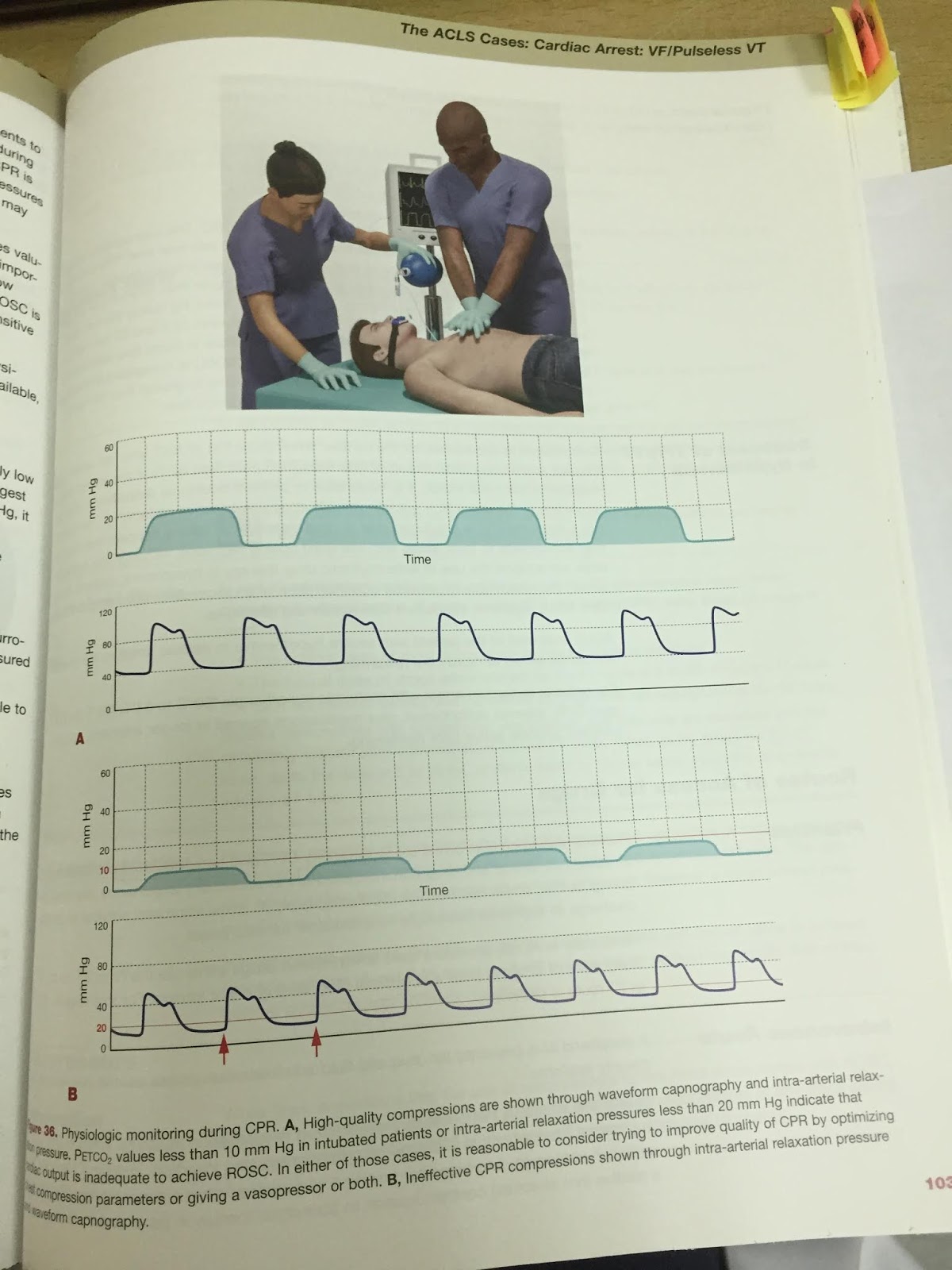 ACLS CHAPTER 5(ACLS CASES -MAIN CHAPTER OF ACLS)