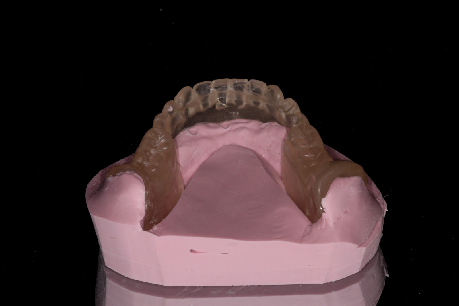 Boise Idaho Prosthodontics: Feb 6, 2012