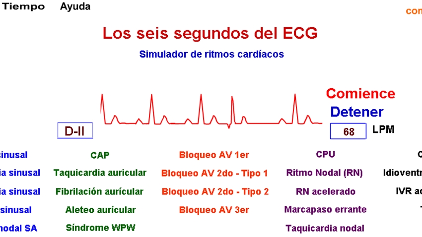Los Seis Segundos del ECG - SkillStat - Simulador EKG | USMP FN Archivos