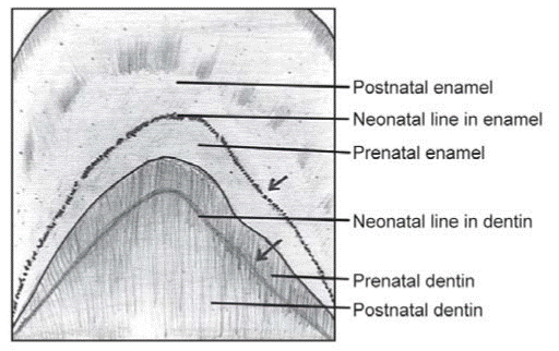 Dentin- Microscopic Structure, Properties, Types and Functions