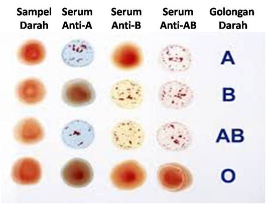 Mari Berbagi: PEMERIKSAAN GOLONGAN DARAH ABO DAN RHESUS, MUDAH DAN ...
