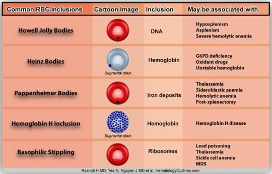 Common RBC inclusion bodies - Howell Jolly, Heinz, Pappenheimer, HbH ...