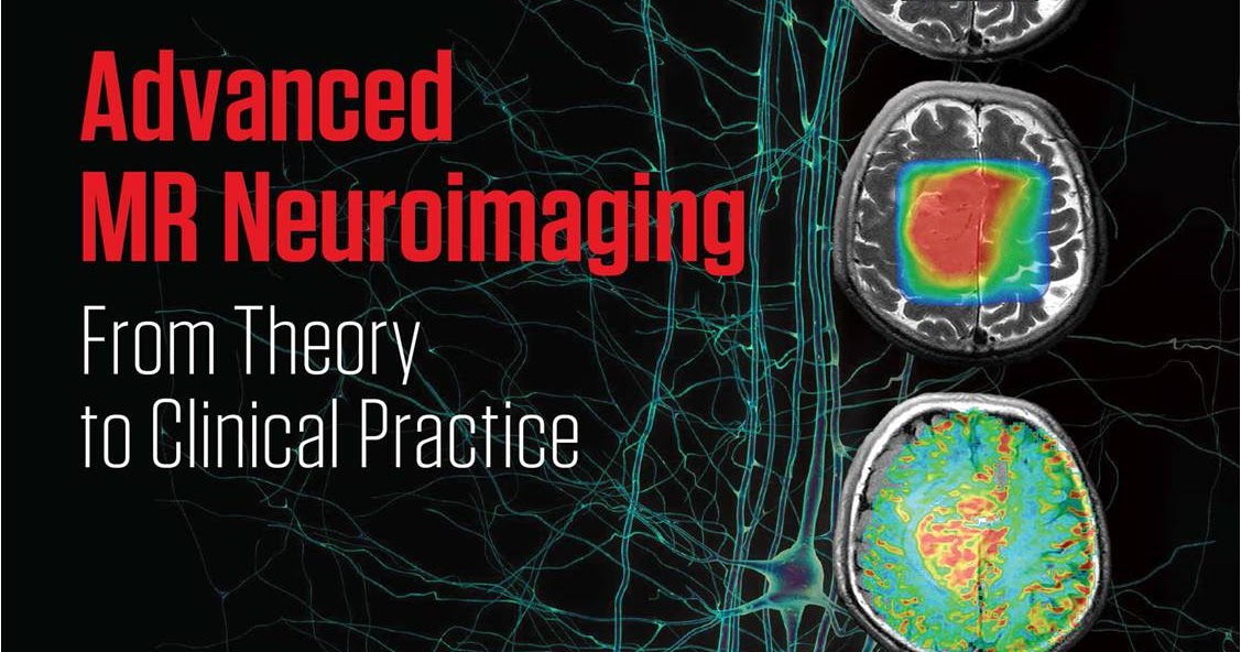 Advanced MR Neuroimaging from Theory to Clinical Practice - Medical Yukti