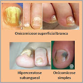 Gold Feet-Clínica de Podologia