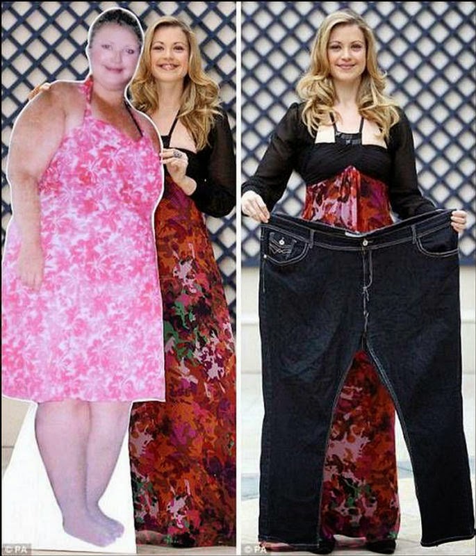 BP: 18 Months in 90 kg weight loss