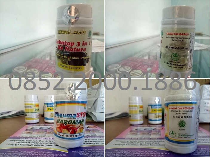 Obat Herbal Untuk Asam Urat | Obat Untuk Asam Urat | Ramuan Untuk Asam Urat