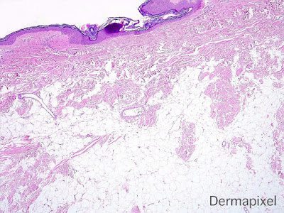 Dermapixel: julio 2021