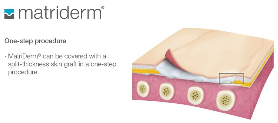 Graftnesis -the infinite regeneration : MatriDerm