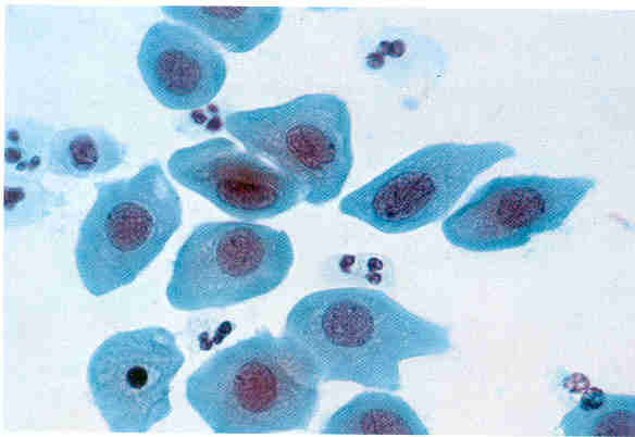 Citomed Citologia: APRENDENDO UM POUCO DE CITOLOGIA