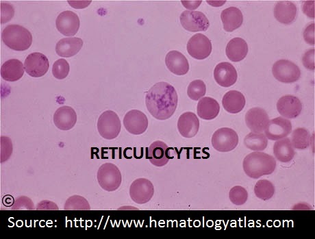 Lab Atlas: Reticulocytes