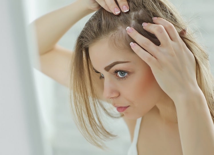 Todo sobre la caída del cabello en mujeres y hombres