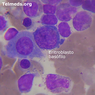 Hematología Fichas: Eritroblasto Basófilo