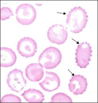 FICHERO DE HEMATOLOGIA: EQUINOCITOS