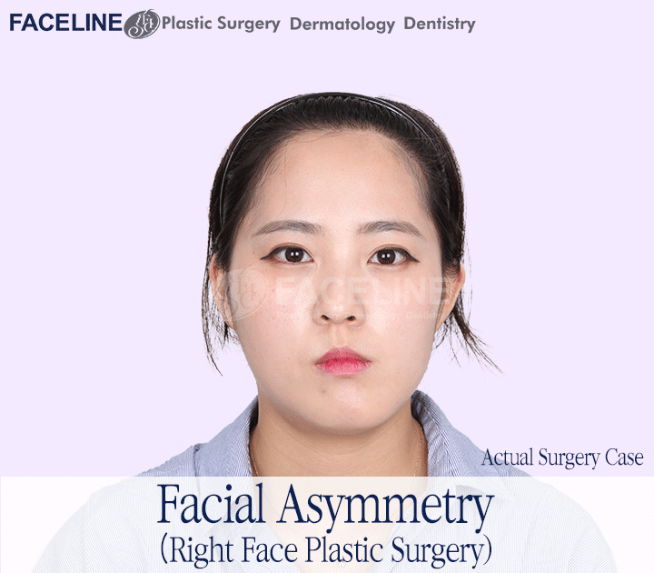 Face asymmetry, what is more important than cost?