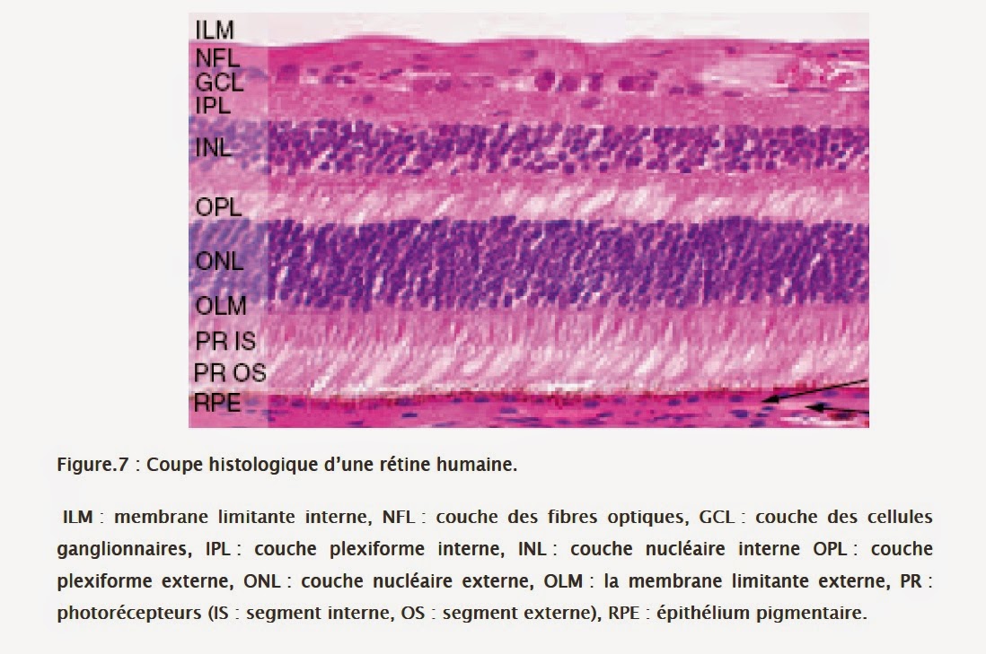 Le blog-notes de la Mansarde: Dyschromatopsies - La balance des ...
