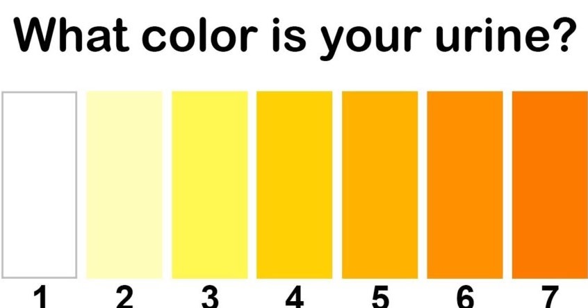 urine color chart - mrs pip | dark yellow urine color chart