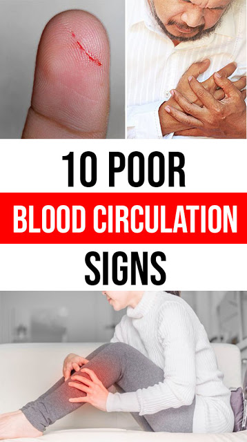 10 Poor Blood Circulation Signs: Are Your Papercuts Taking WAY Too Long ...