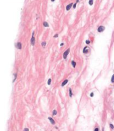 MoyinAdesanyaBiol 3500: The Human Appendix: My Favorite Organ: The ...