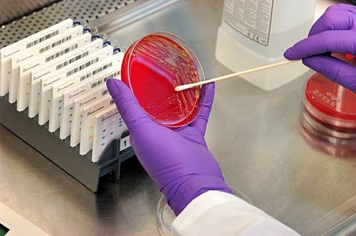 View From The Petri Dish: Tips for Aseptic Technique in the Laboratory ...