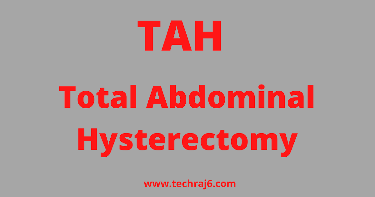 TAH full form, What is the full form of TAH