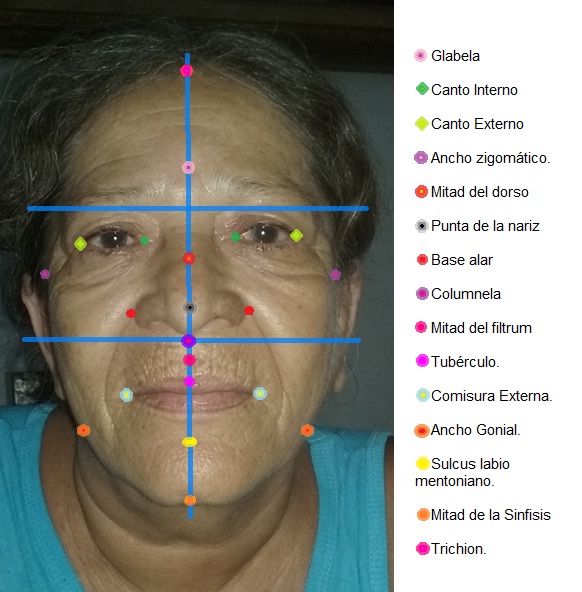 Odontología Maria Alejandra Quintero 2015-II: Análisis Clínico Facial