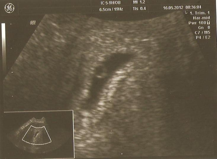 The Infertile Crescent: 5w3d...