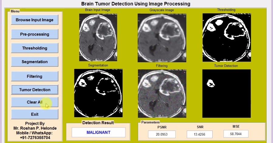 Brain Tumor Detection And Classification Using Image Processing Full