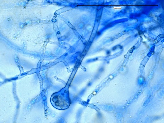 Fun With Microbiology (What's Buggin' You?): Apophysomyces elegans ...