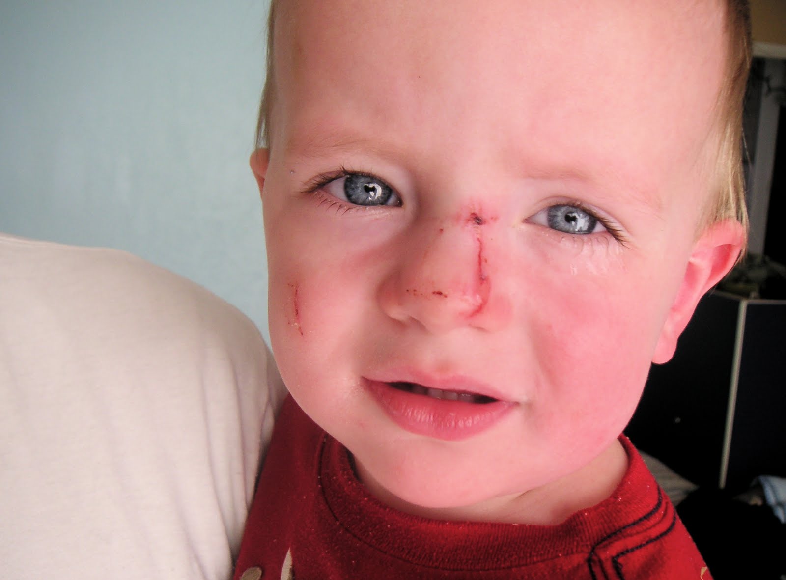 photos by amanda j: Week 22b: Bruised and Broken