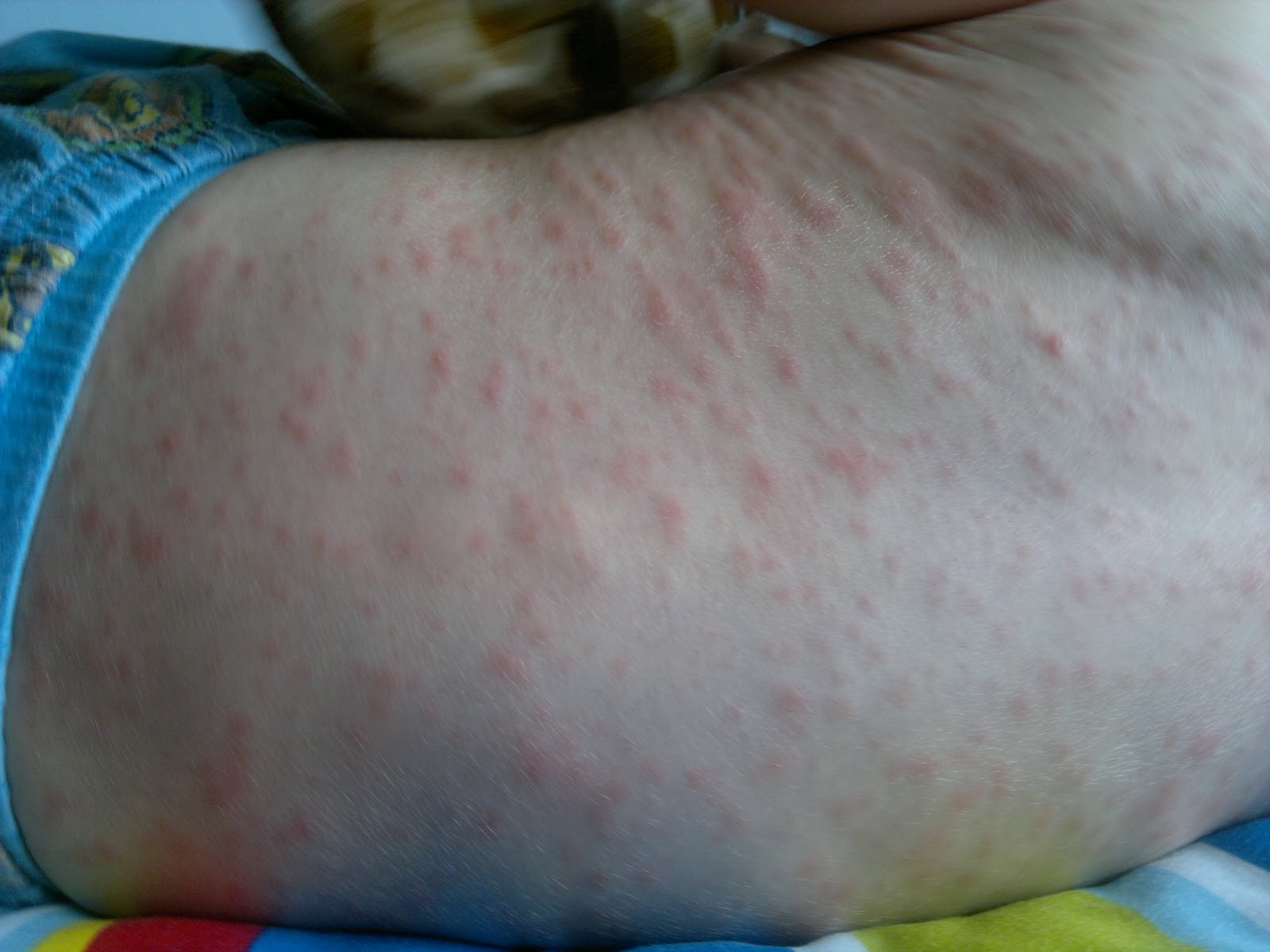 My mamma-wees-ervarings...: Siek kinders...virale infeksies...allergiee ...