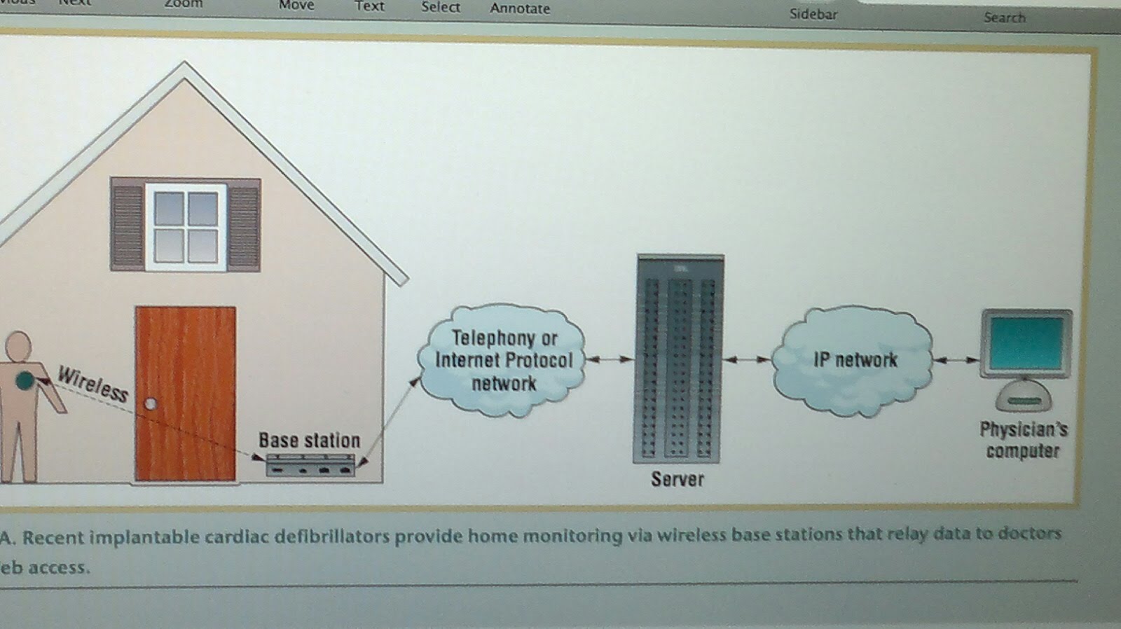 Los Angeles / Monterey Peninsula Targeted Individual (Alda) : DARPA N3 ...