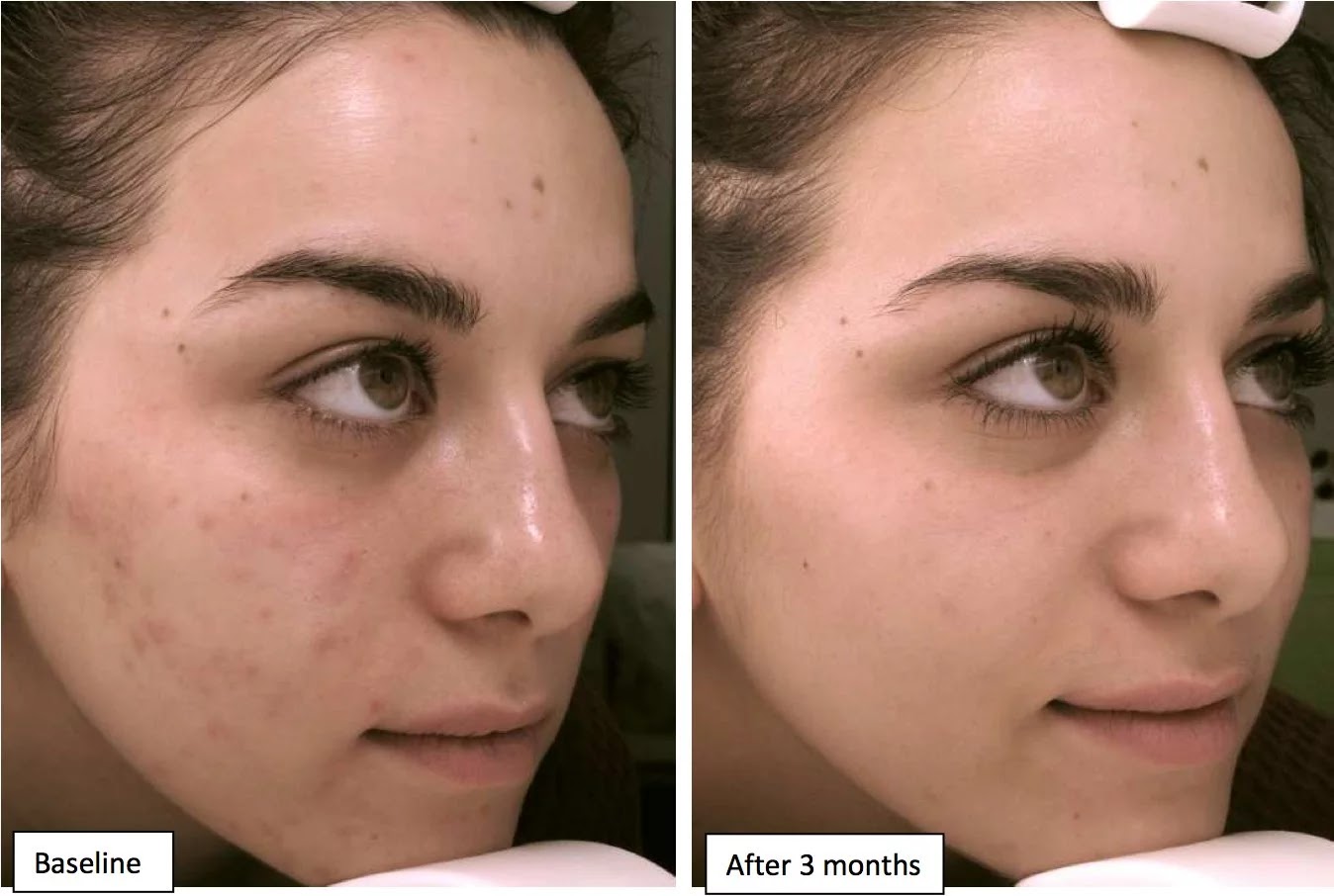 10 Shocking Benefits Of Vicks Vaporub You Didn’t Know - crazzy craft