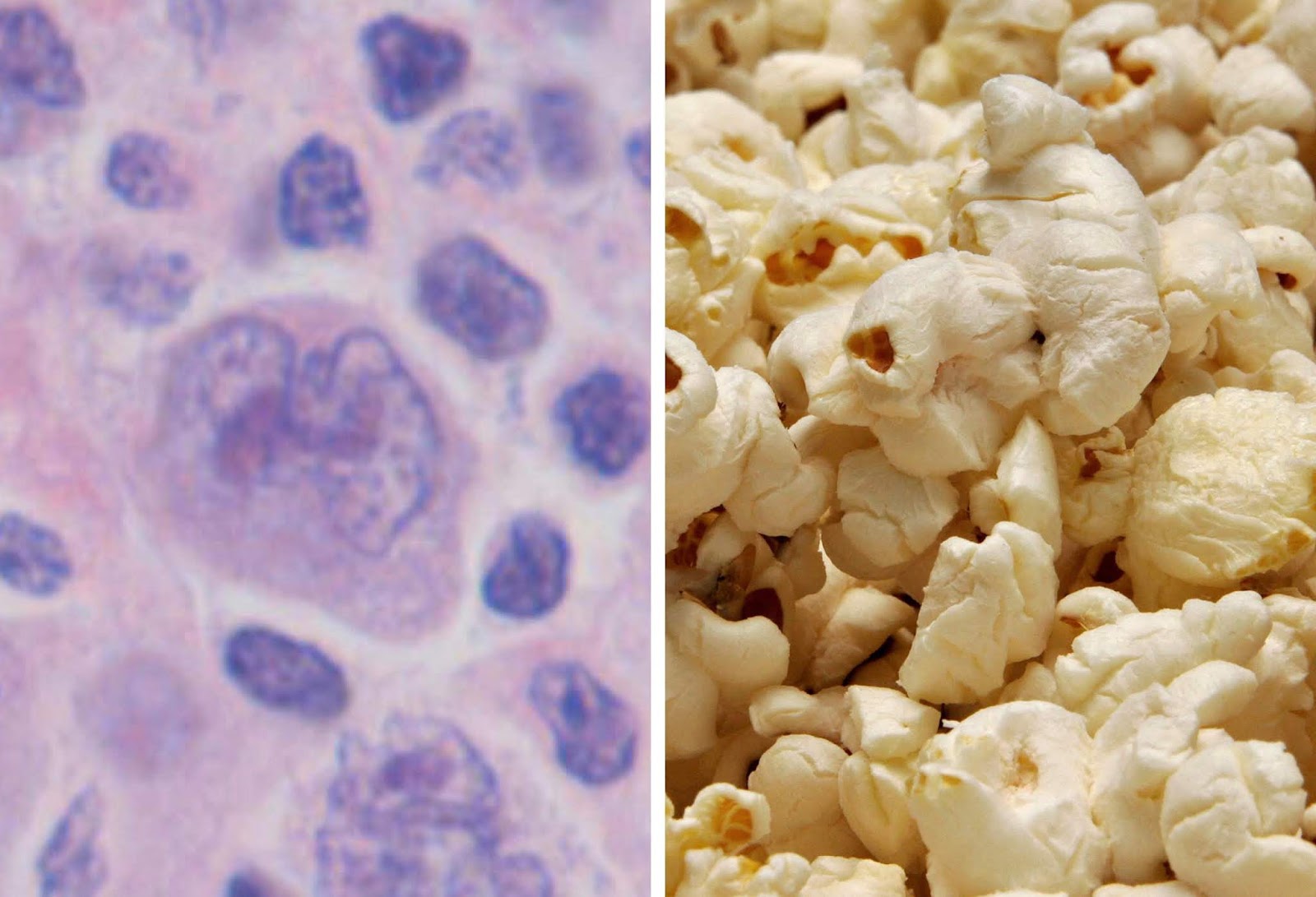 史丹福狂想曲: 血液細胞狂歡大食會2