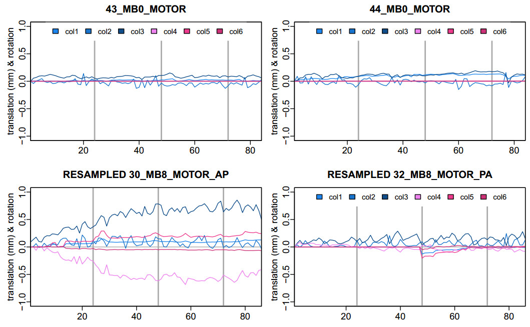 MVPA Meanderings: multiband acquisition sequence testing: respiration