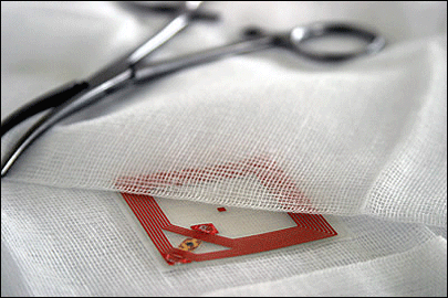 RFID Technology in Building Smart Hospitals