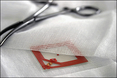 RFID Technology in Building Smart Hospitals