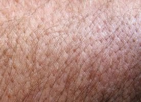 NewsForYou: How to Remove Skin Tags With Duct Tape