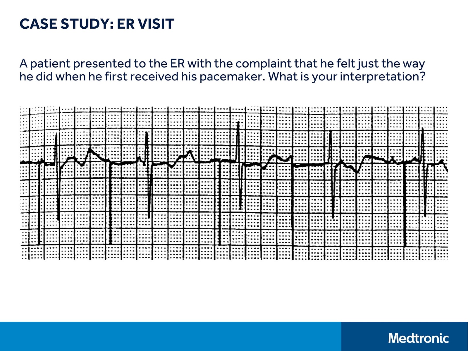 CVT Mohd Farid: Basic Pacing Concepts Part II-Medtronic Academy