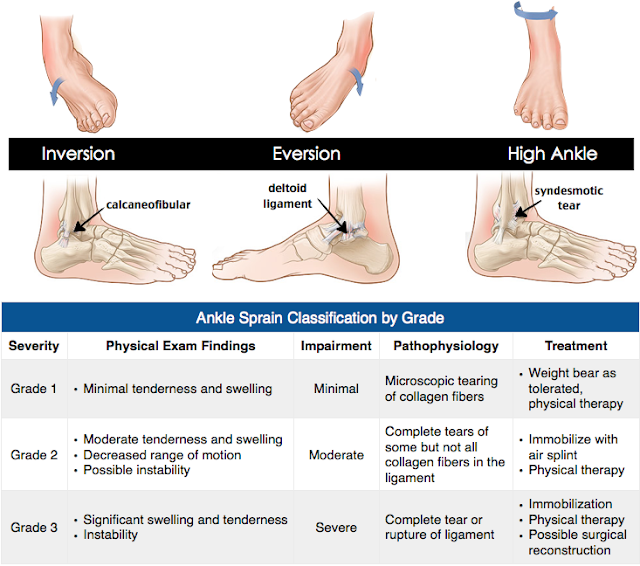 ANKLE SPRAIN