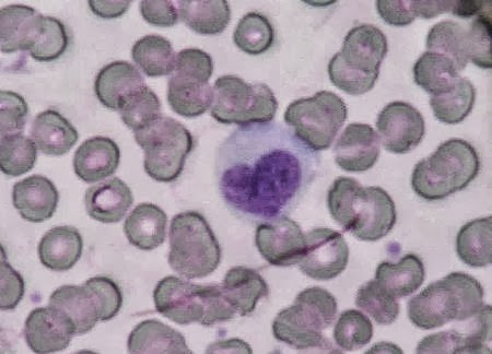 Medical Laboratory and Biomedical Science: The heart of monocyte