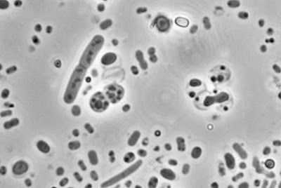 Всё о бегониях и не только...: Картофельная палочка (Bacillus ...