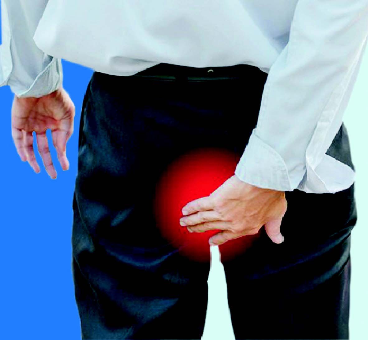 Apa Saja Tanda dan Gejala Wasir?