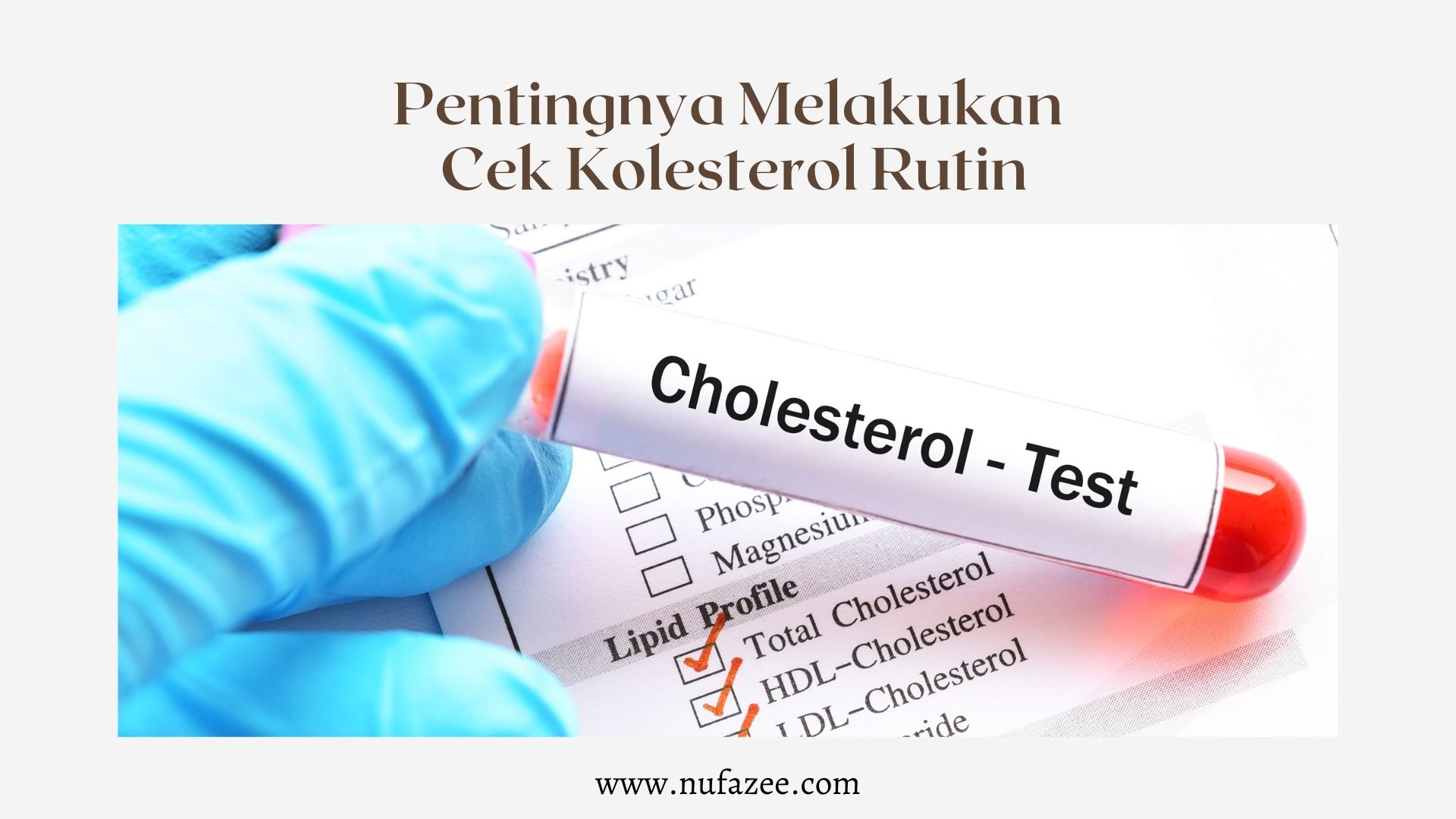 Inilah Pentingnya Melakukan Cek Kolesterol Rutin – Nufazee.com