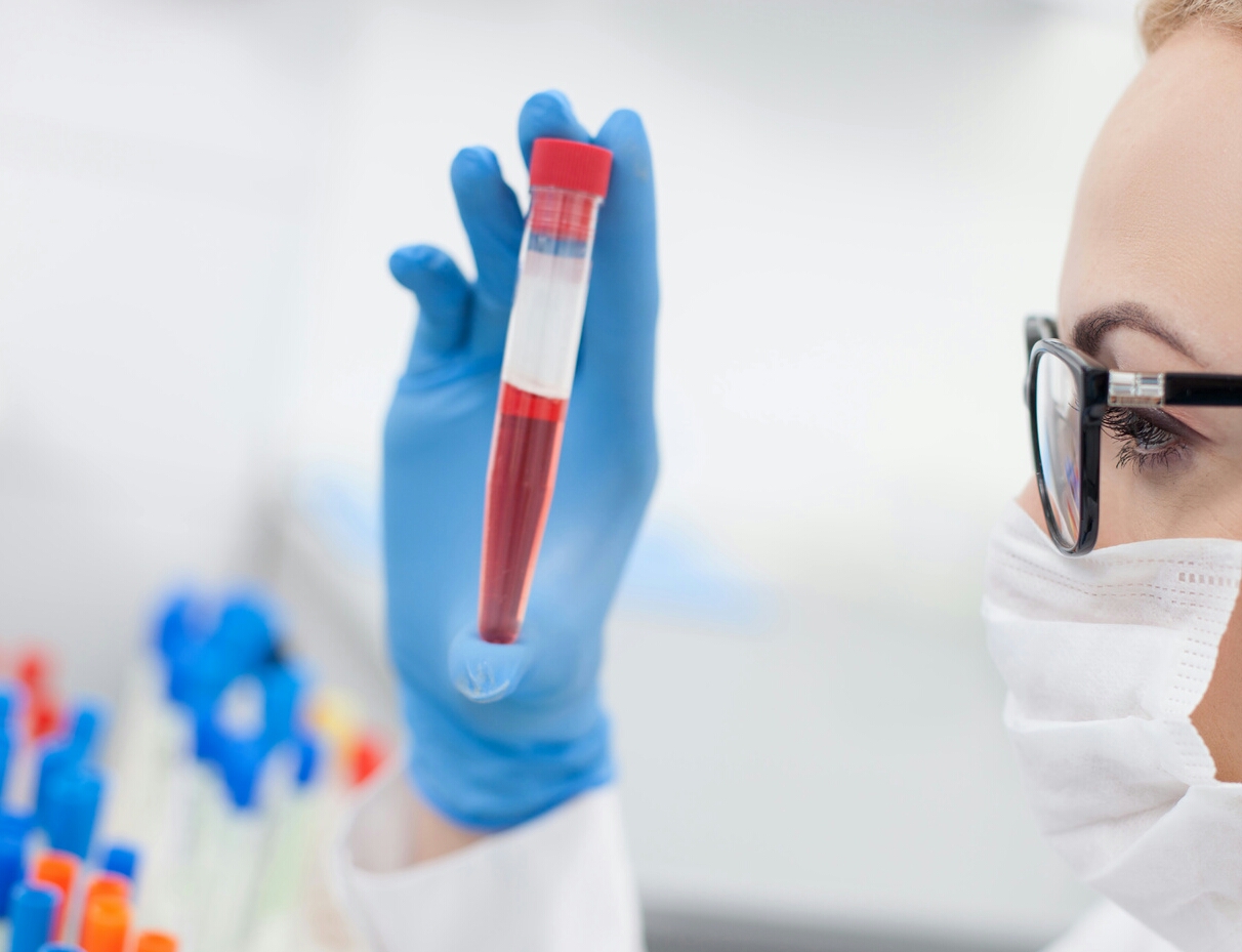 HÙMÀÑ ŚĆIĘNĆĘ: Artificial Blood : Substitute of Red Blood Cells